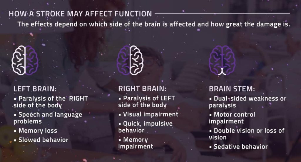 In-Home Care - Managing Post-Stroke Symptoms | Angels on CAll Homecare